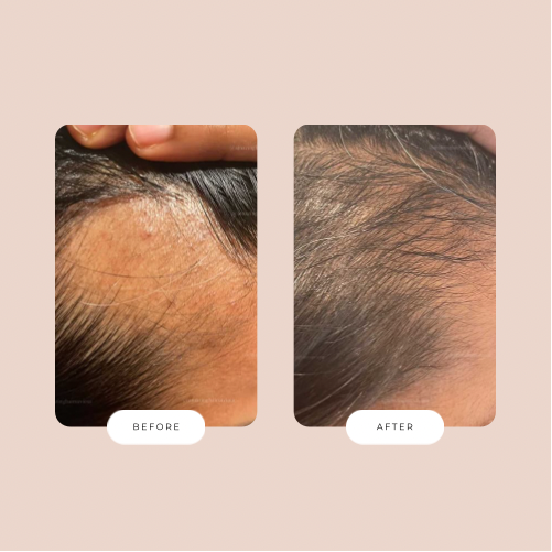 Before & After – Amazing Hair Saviour