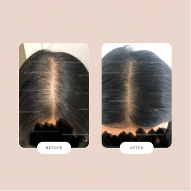 Before & After – Amazing Hair Saviour