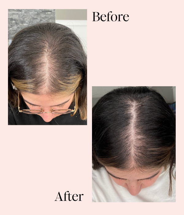 Before & After – Amazing Hair Saviour